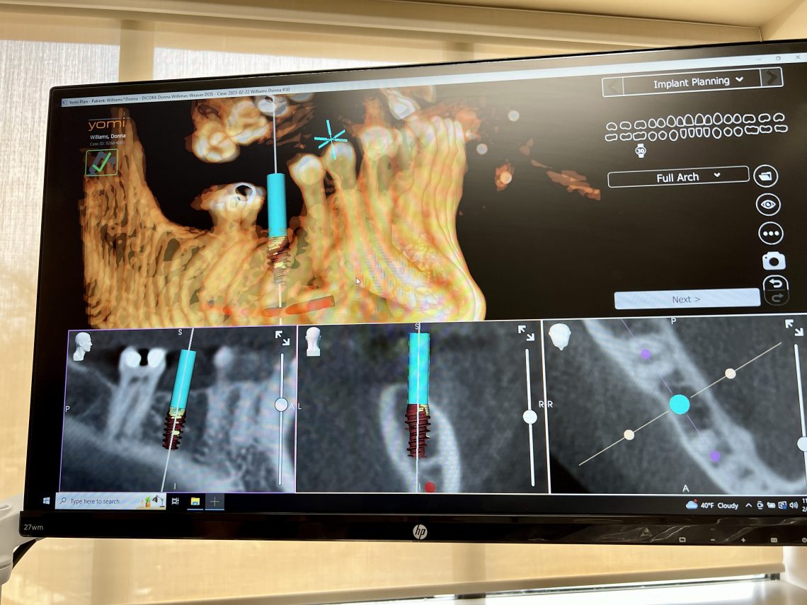West Hartford Oral Surgeon Pioneers Robotics - We-Ha | West Hartford News West Hartford Oral Surgeon Pioneers Robotics - We-Ha | West Hartford News